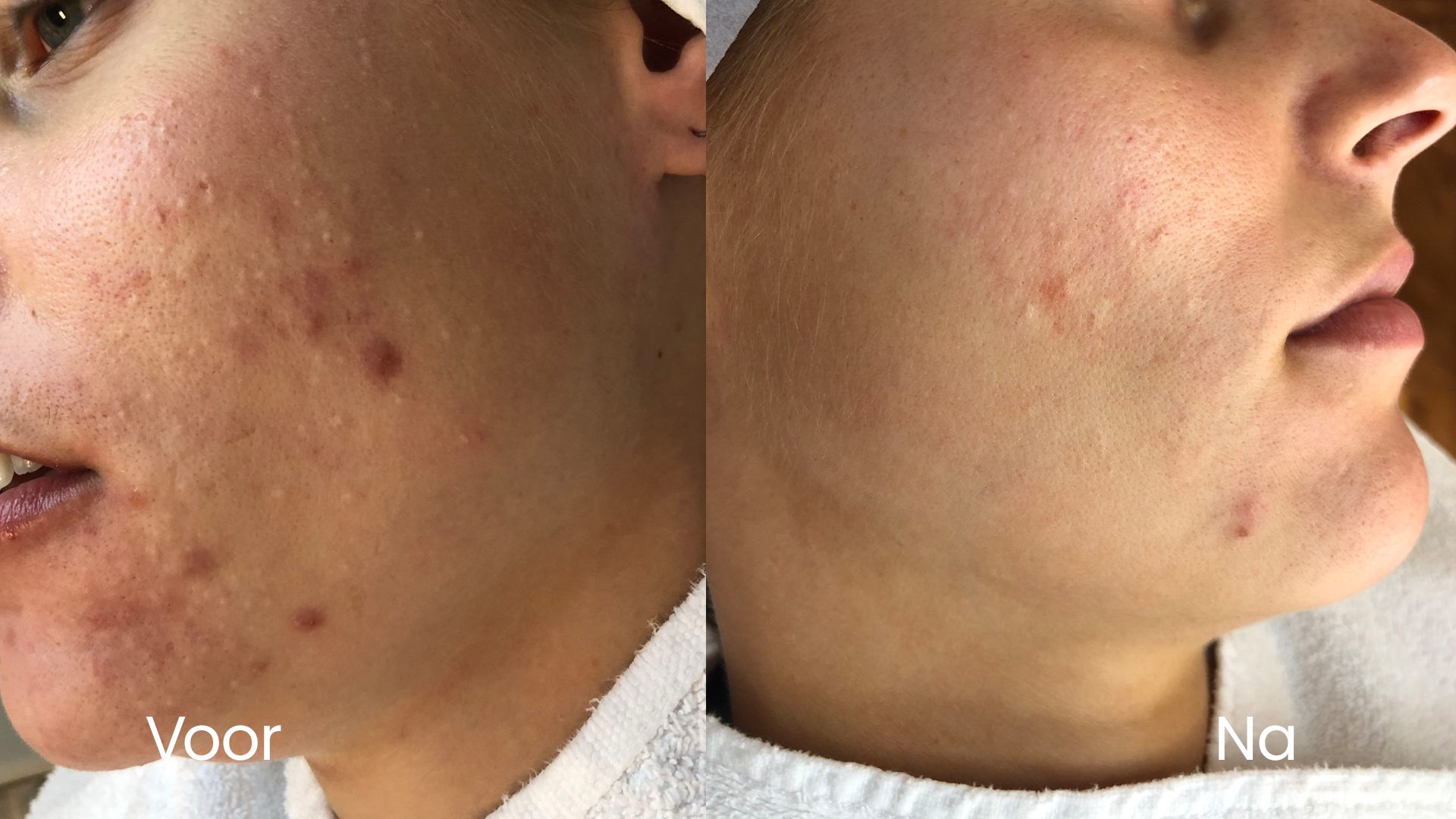 Huid - Huidtherapie in Rotterdam & Den Haag | Erkende kliniek